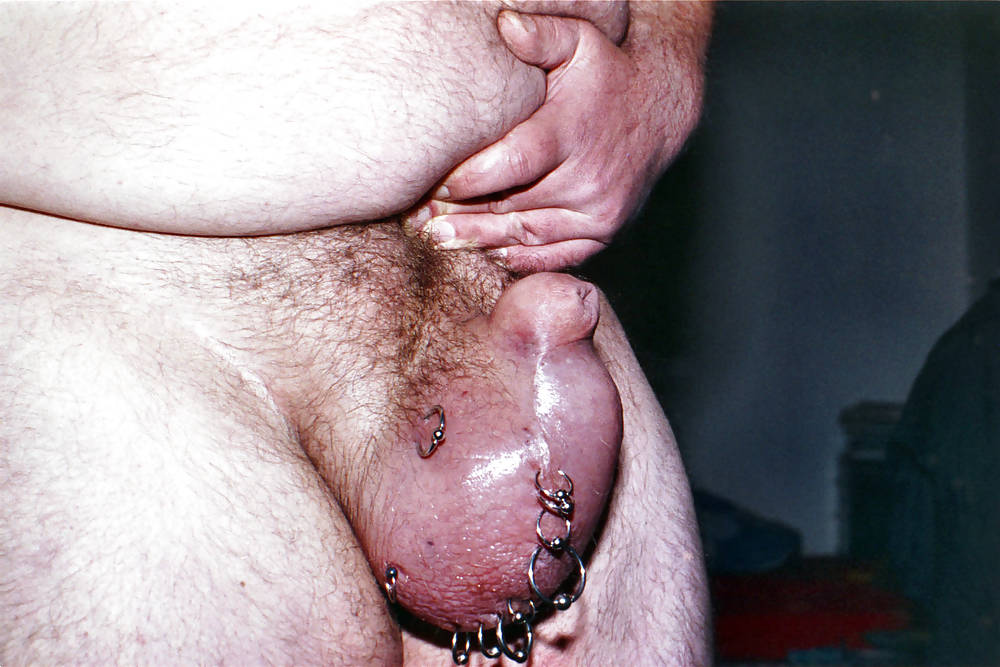 Hoden Scrotum Infusion Porn Pictures Xxx Photos Sex Images 911576